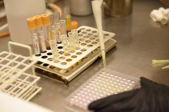 El Perrupato cuenta con un laboratorio de PCR isotérmico - Mendoza Post