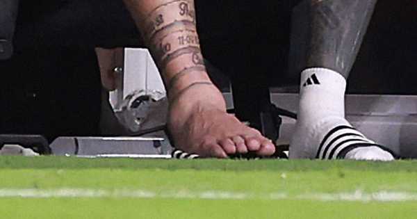 IMAGEN IMPACTANTE: así le quedó el TOBILLO a LIONEL MESSI - Mendoza Post