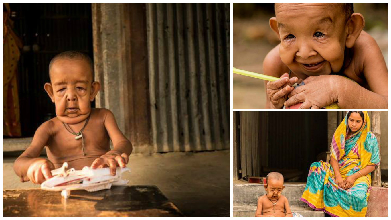 Un Benjamin Button en la vida real - Mendoza Post